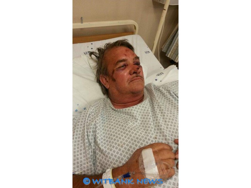 Panga-aanval slagoffer verlig oor polisie se besoek | Witbank News