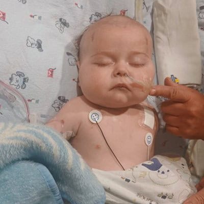 Rare disease, unstoppable spirit: Wilderness toddler breathes on his ...