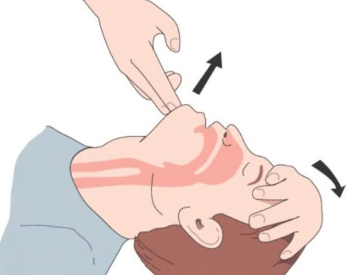 Swimming pool safety and CPR | Letaba Herald