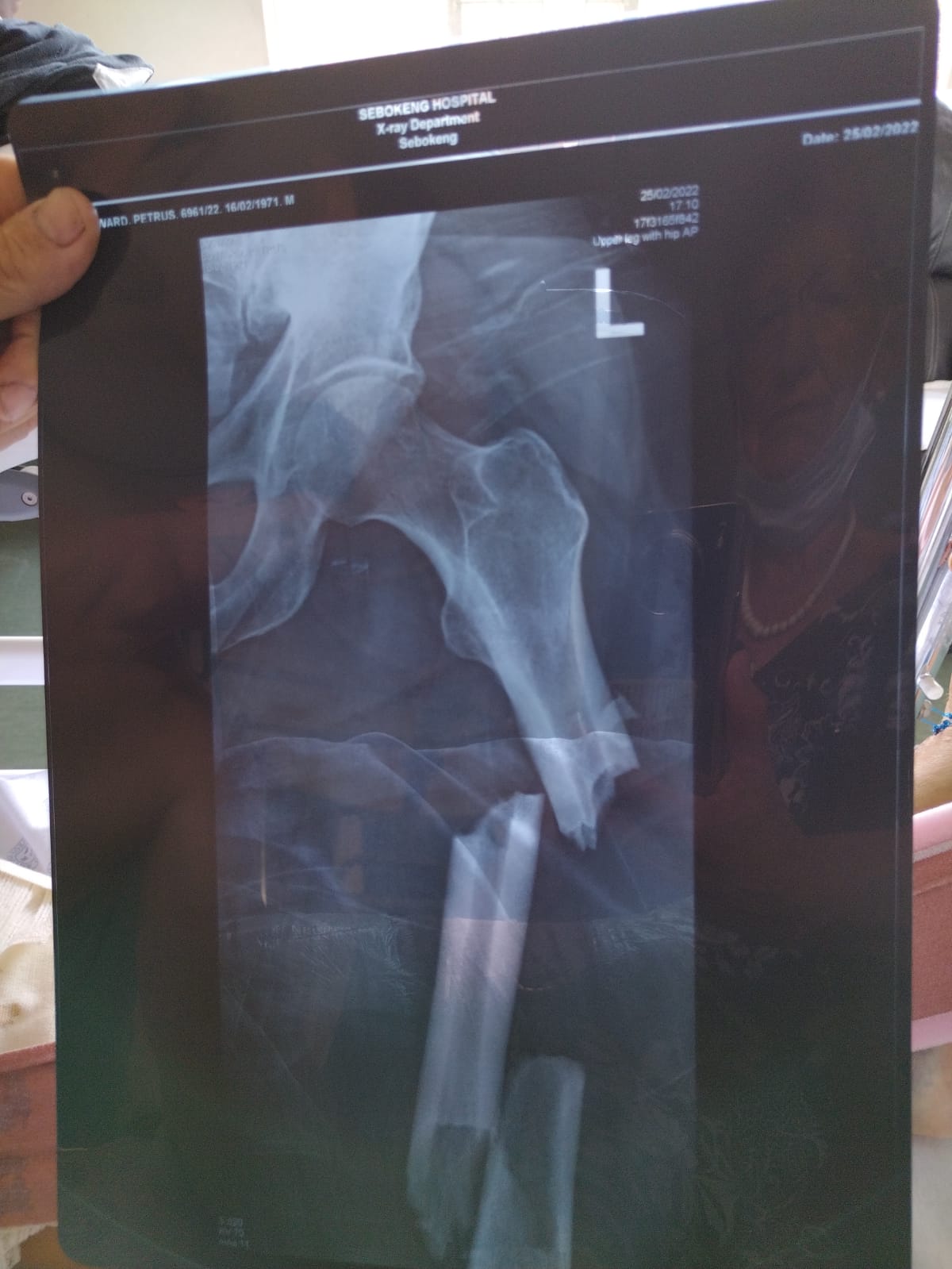 Man pleit vir operasie na 10 weke in hospitaal | Vaalweekblad