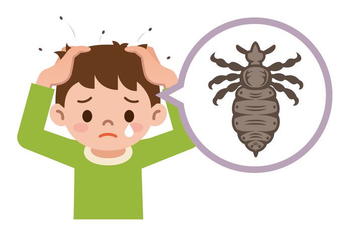 Critter alert: What to do if your child has lice | Kathorus Mail