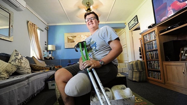 ‘I saw my leg was gone’ | The Witness