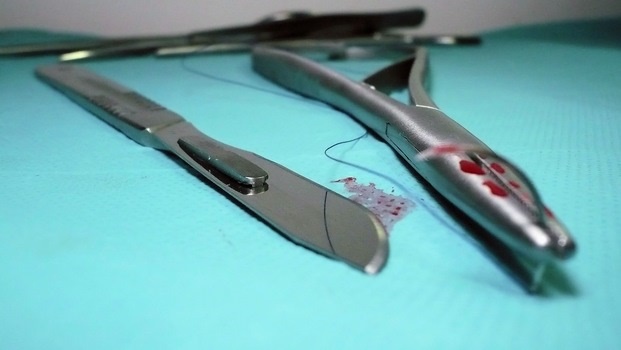 Anger over unlawful circumcision | The Witness