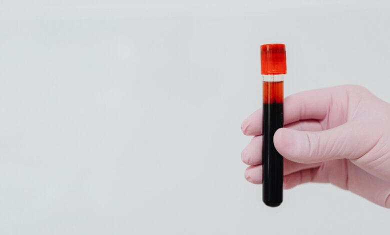 Blood cancer myths debunked on World Blood Cancer Day | The Witness