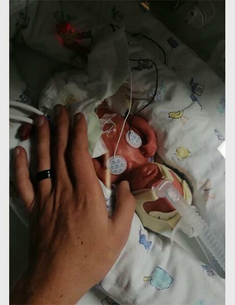 Vroeggebore baba vaar goed | Springs Advertiser