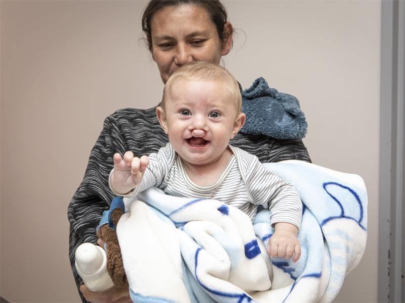 Operation Smile SA calls for families ahead of cleft surgery weekend at ...