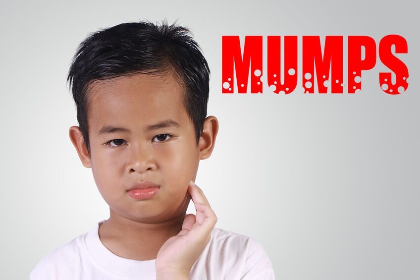 What you need to know about mumps | Comaro Chronicle