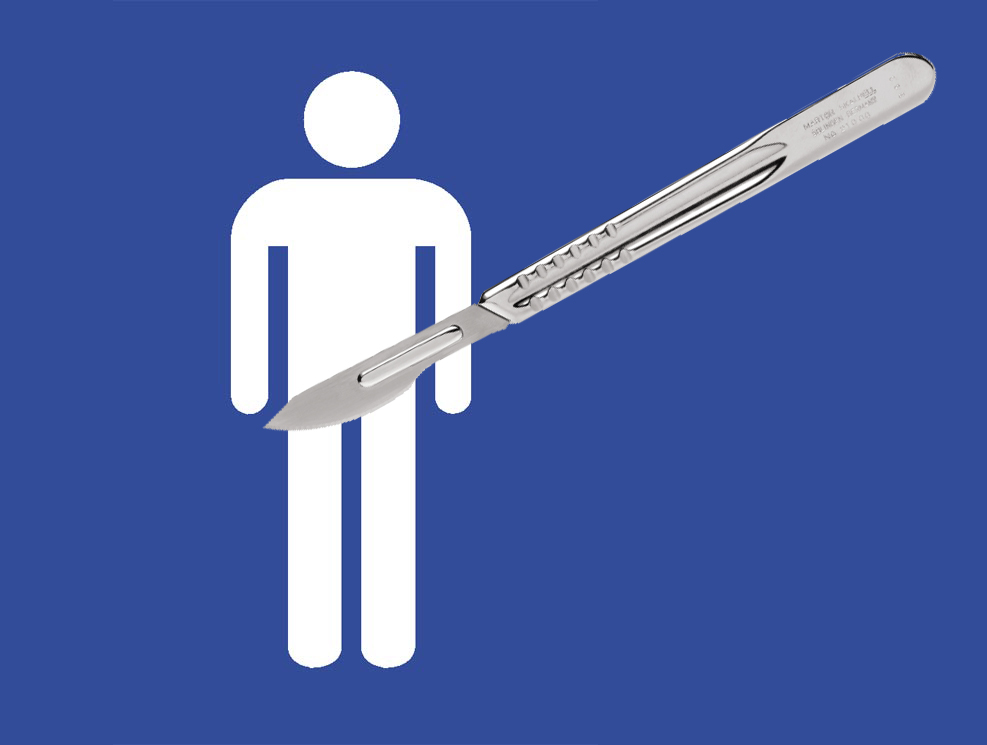 Male circumcision: To snip or not to snip? | Lowvelder