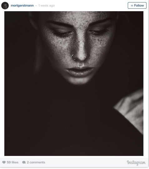 The reason behind those fabulous freckles | Zululand Observer