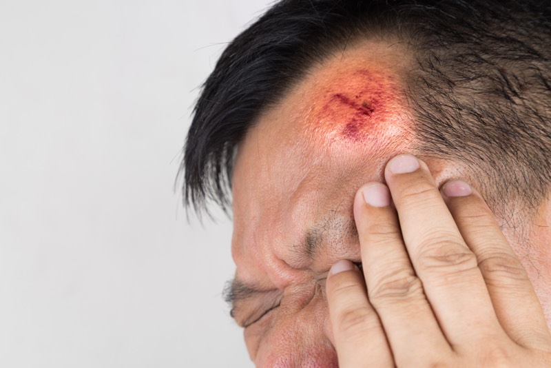 Head injuries: spot the warning signs | Zululand Observer