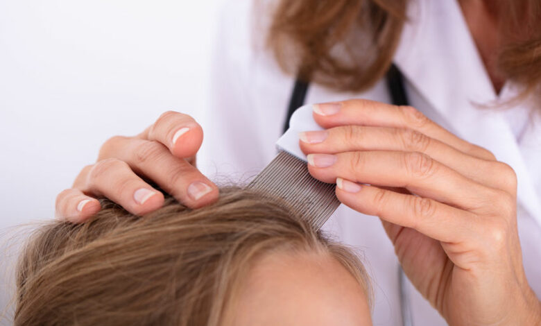 Dealing with head lice in children: Tips for parents | Eyethu News
