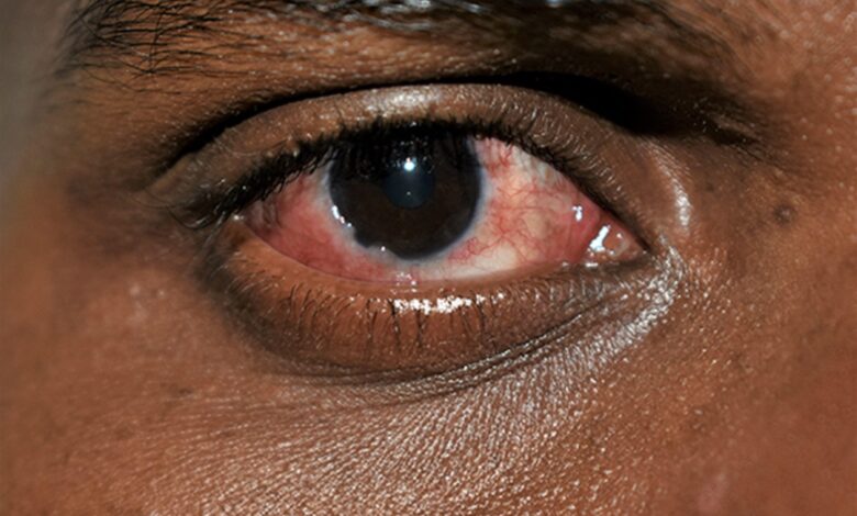 Zidla lubi ezophenyane eThekwini | Eyethu News
