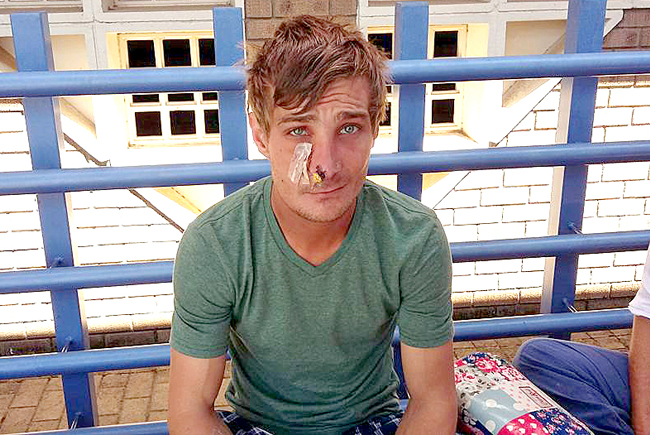 Jacques Vorster sterk aan na skoot in gesig | Review