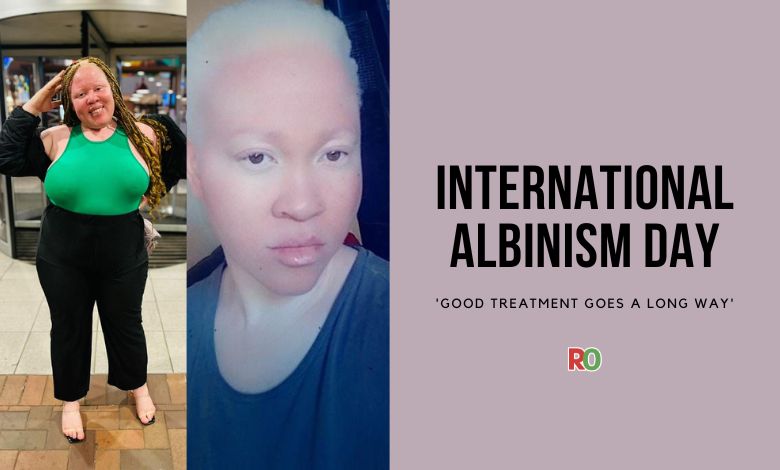 International Albinism Day: Good treatment goes a long way | Review