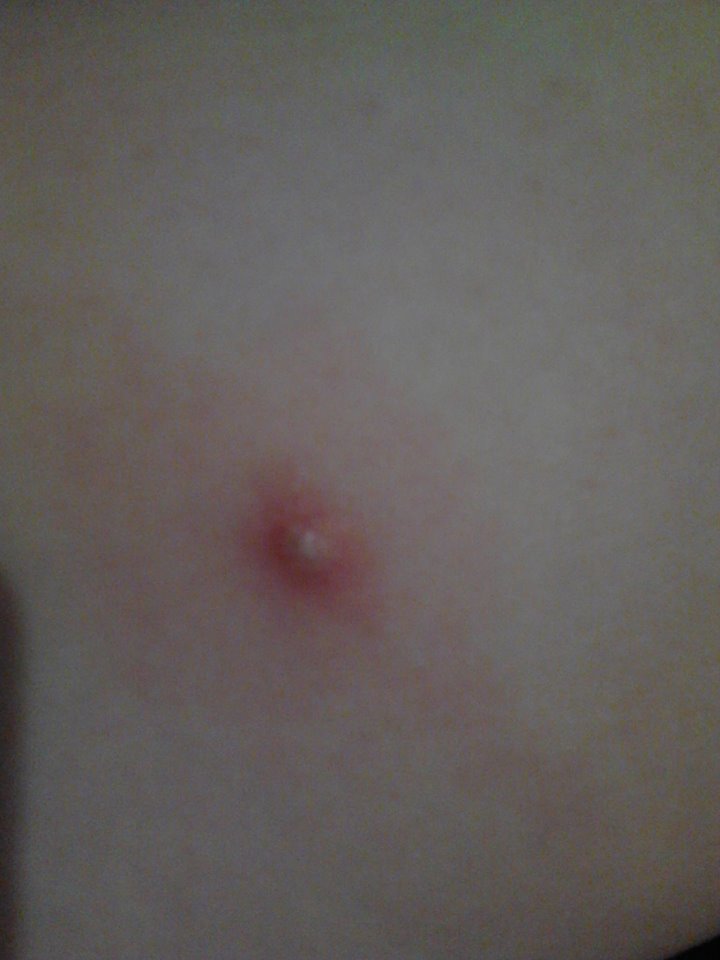 OPVOLG: Wat jy moet weet oor die mango/vrugtevlieg besmetting | Rekord