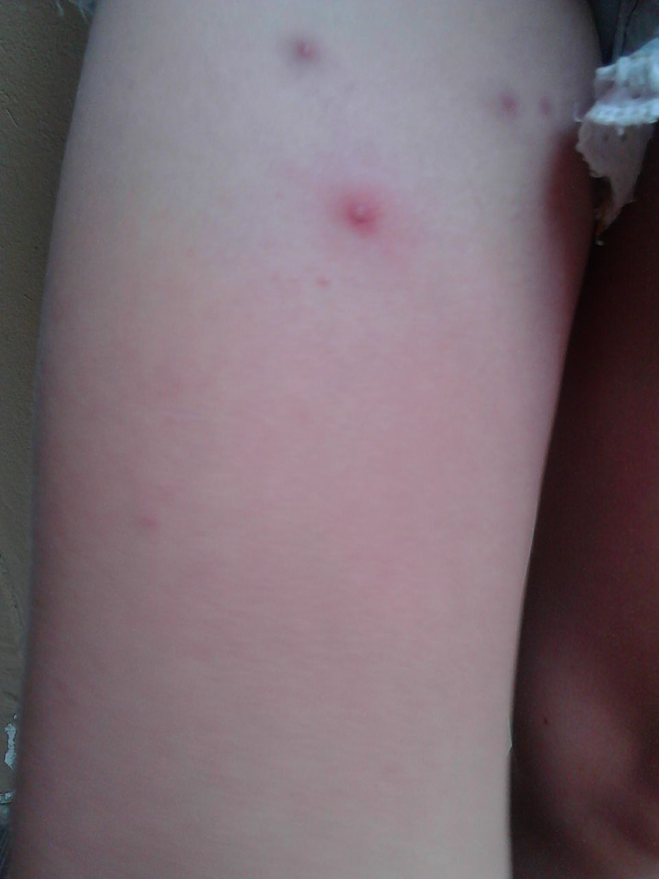 OPVOLG: Wat jy moet weet oor die mango/vrugtevlieg besmetting | Rekord