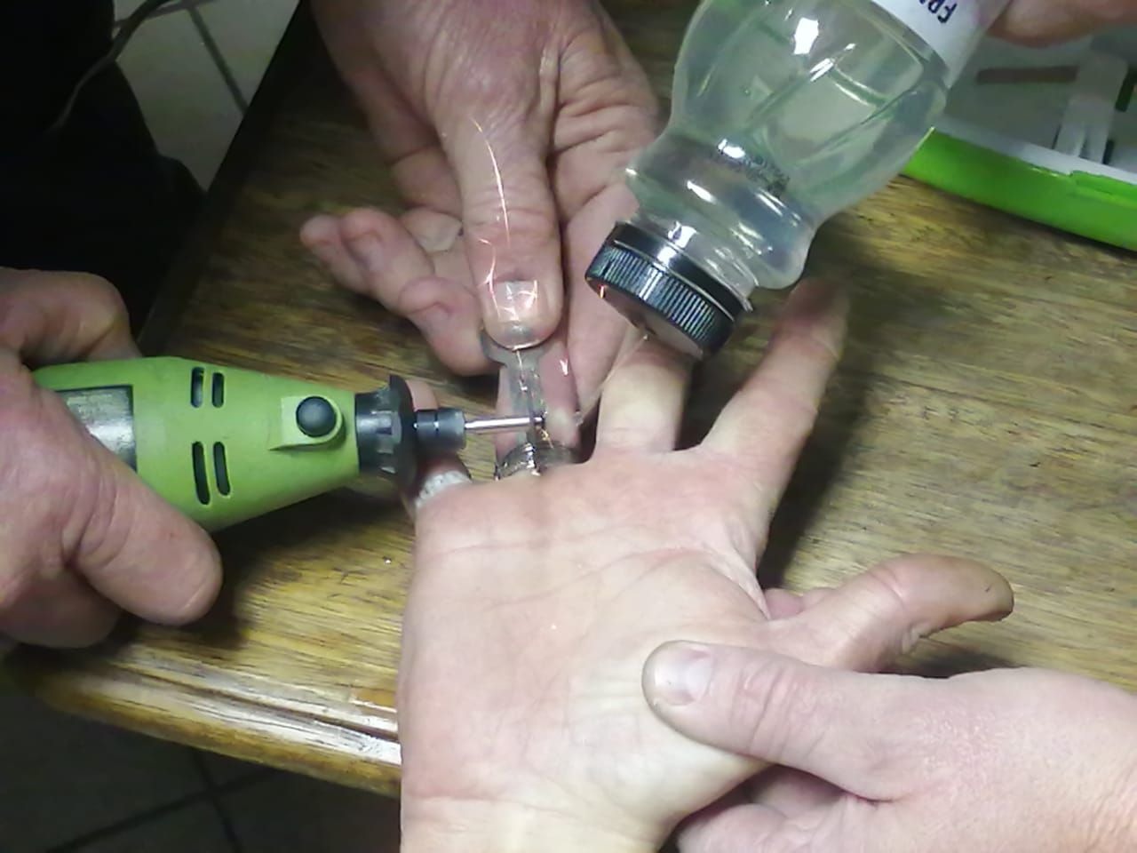 Tshwane firefighters save man’s fingers | Rekord