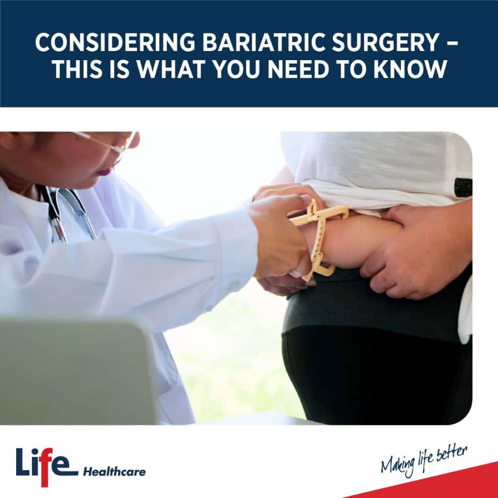 What you should know about bariatric surgery | Rekord