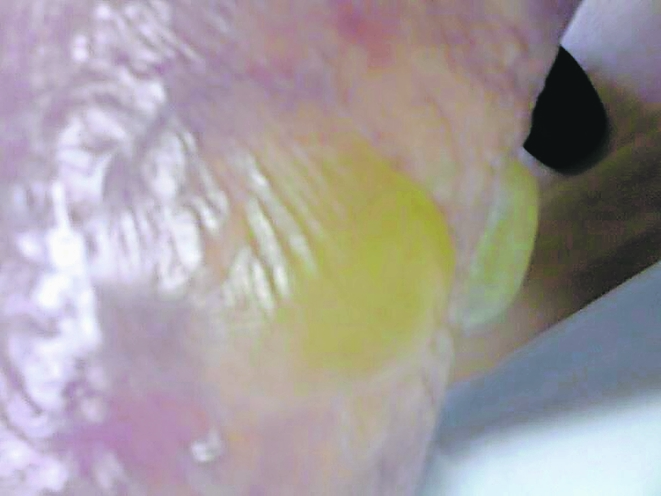 (Grafiese Inhoud) Watter spinnekop het my gebyt? | Middelburg Observer