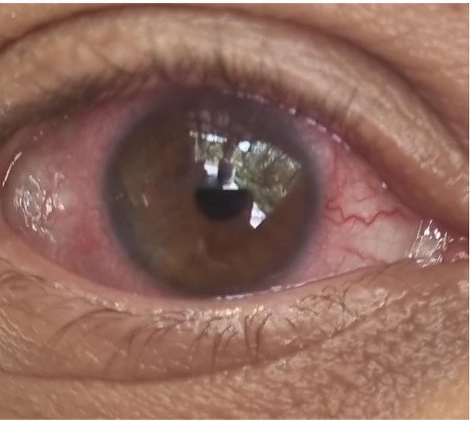 Vuiste klap by kuierplek - onskuldige platgeslaan | Middelburg Observer