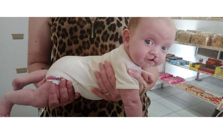 Help vir baba Hanro | Middelburg Observer