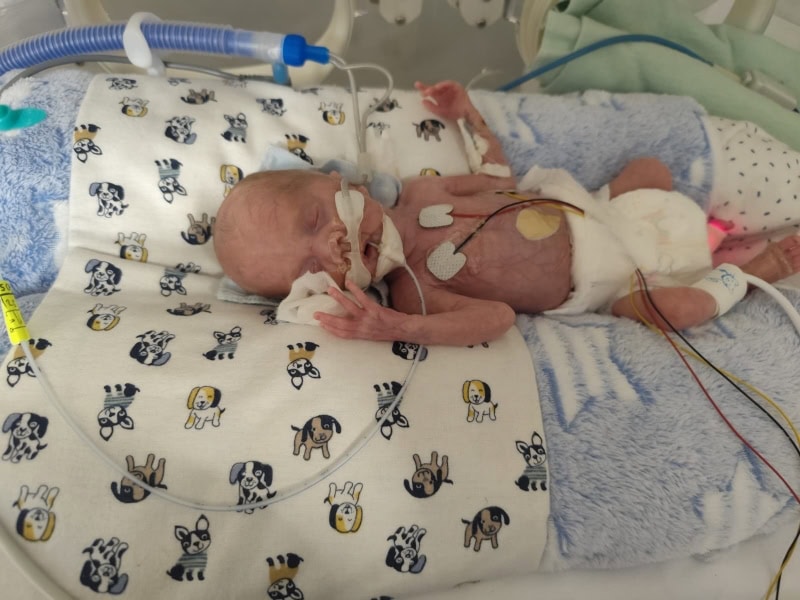 NICU bills racking up for miracle baby Ayden | Middelburg Observer