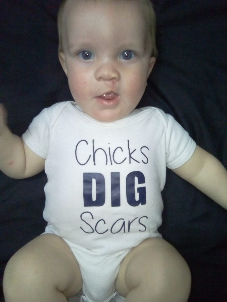 VIDEO: JP Putter ondergaan tweede operasie om gesplete lip en ...