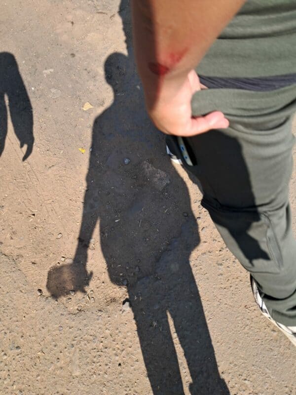Ermelo march: claims of rubber bullet injuries and police intervention ...