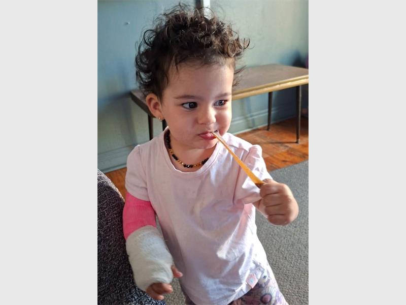 Dogtertjie met gebreekte arm kort dringend operasie op Trichardt ...